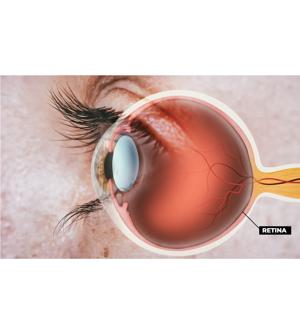 Surgical Retina Specialists Sydney | Central Sydney Eye Surgeons